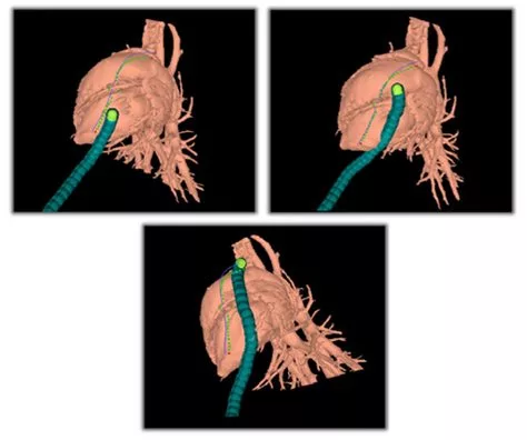 Understanding SLAM in Robotics and Autonomous Vehicles